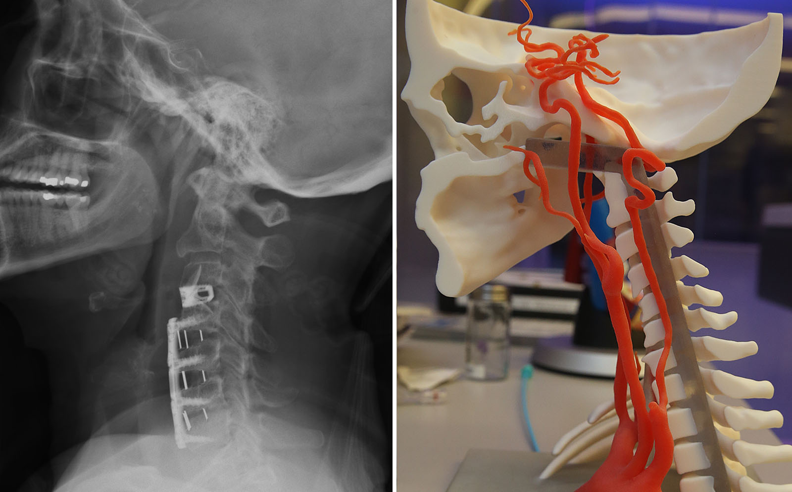 How lifelike 3D exhibits helped settle a $3.5 million personal injury ...